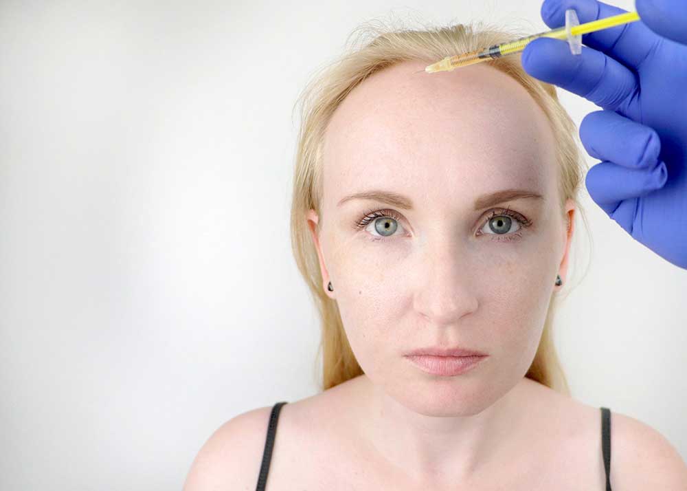 Hair Transplants For Women Estevitalya Hair Clinic