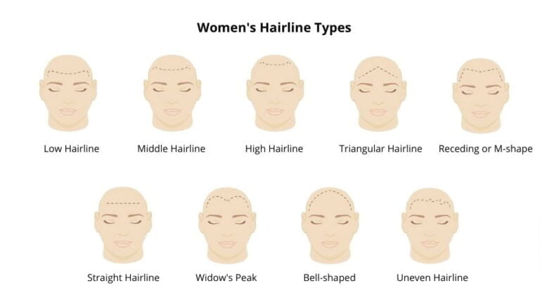 Understanding Hair Transplant: Guide to Different Hairline Types